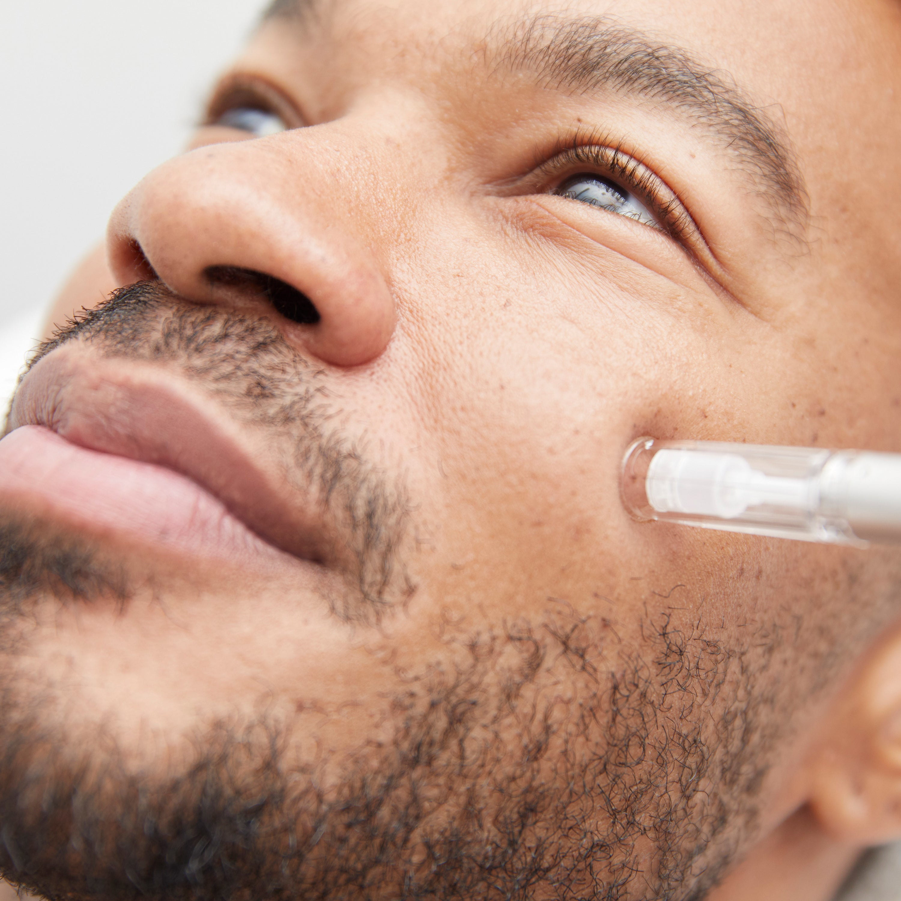 Skin Needling Treatments – Microneedling – Body Sculpting Clinics