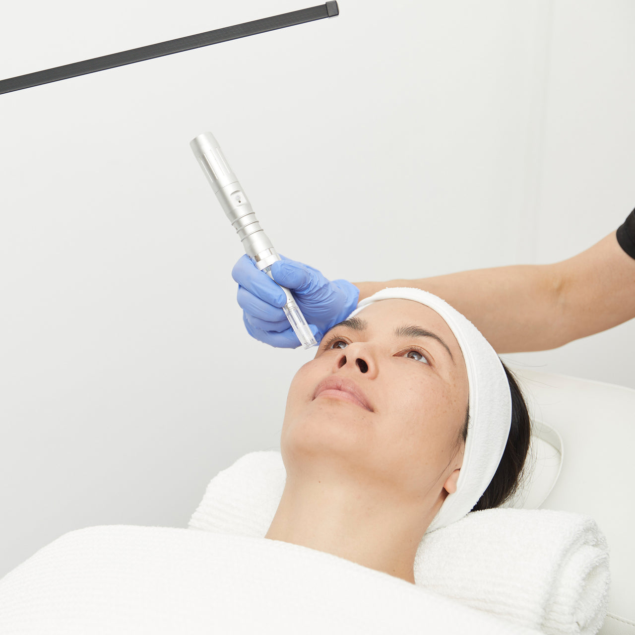 Skin Needling Treatments – Microneedling – Body Sculpting Clinics