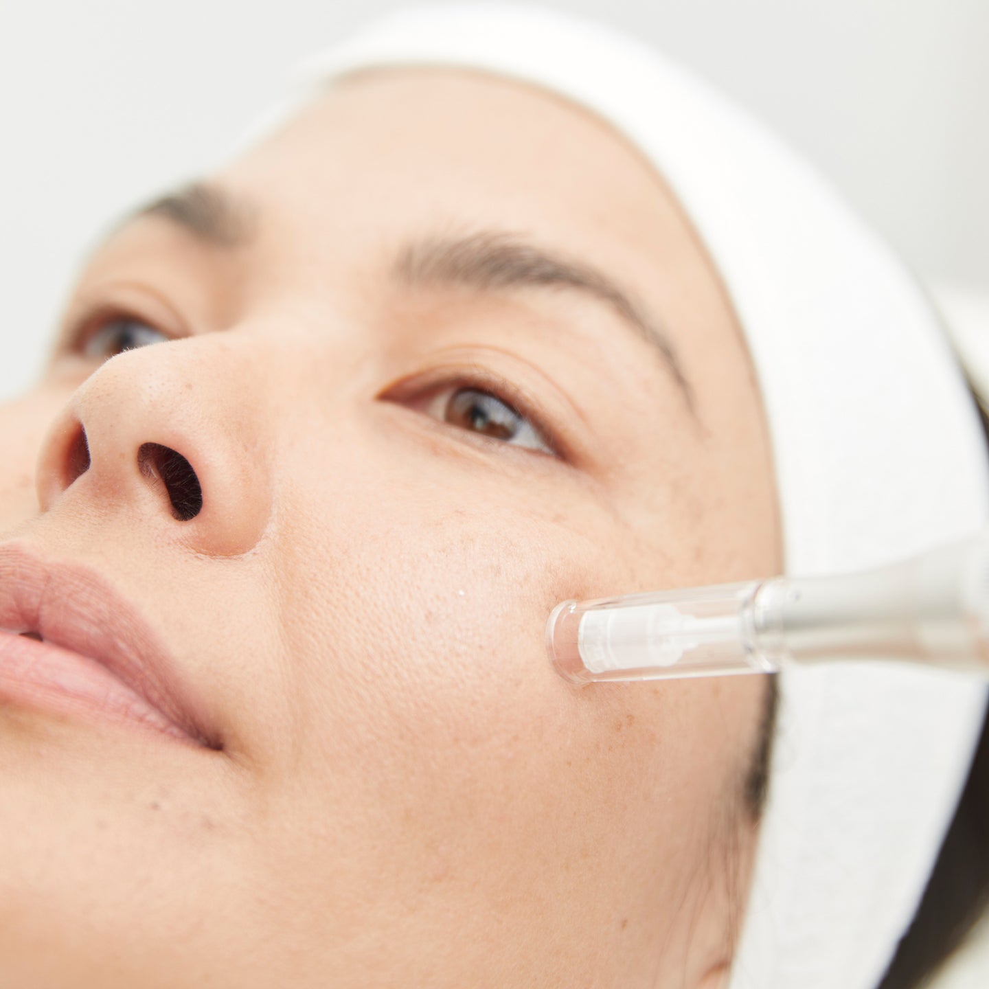Skin Needling Treatments – Microneedling – Body Sculpting Clinics